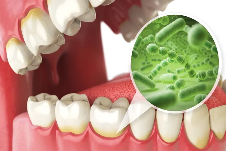 Measuring oral bacterial levels key to detect Alzheimer’s risk early